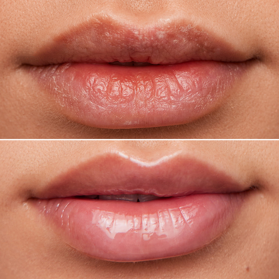 Lip Rehab Serum Oil – Wonderskin EU